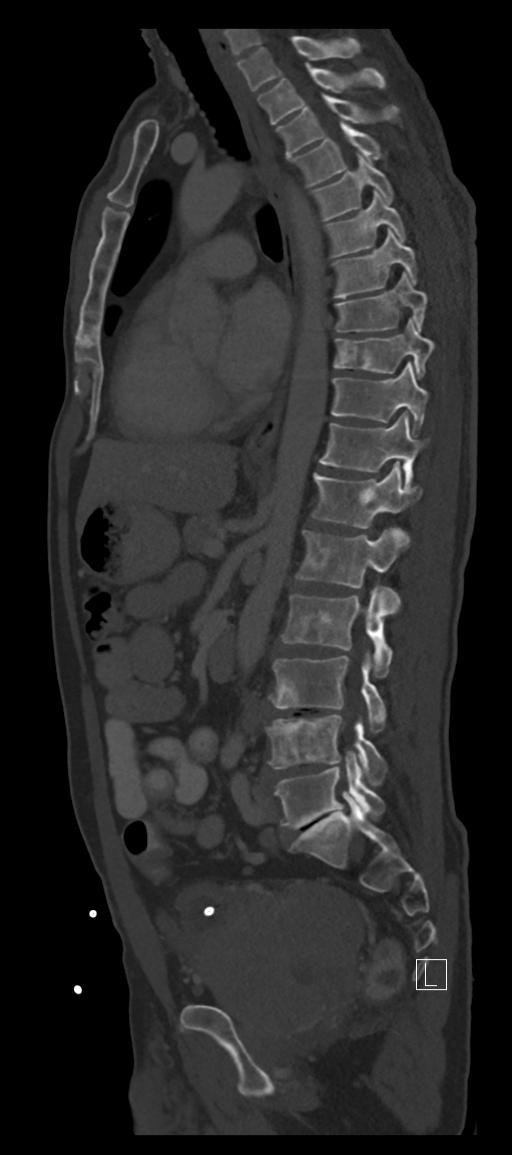 Diagnostik | Urologie Amriswil