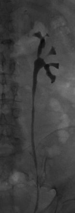 Moderne Bildgebung und Röntgenuntersuchung in der Urologie | Urologie ...